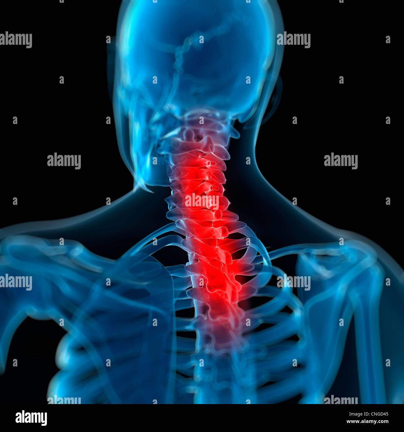 Picture Of Back Pain High Resolution Stock Photography and Images - Alamy