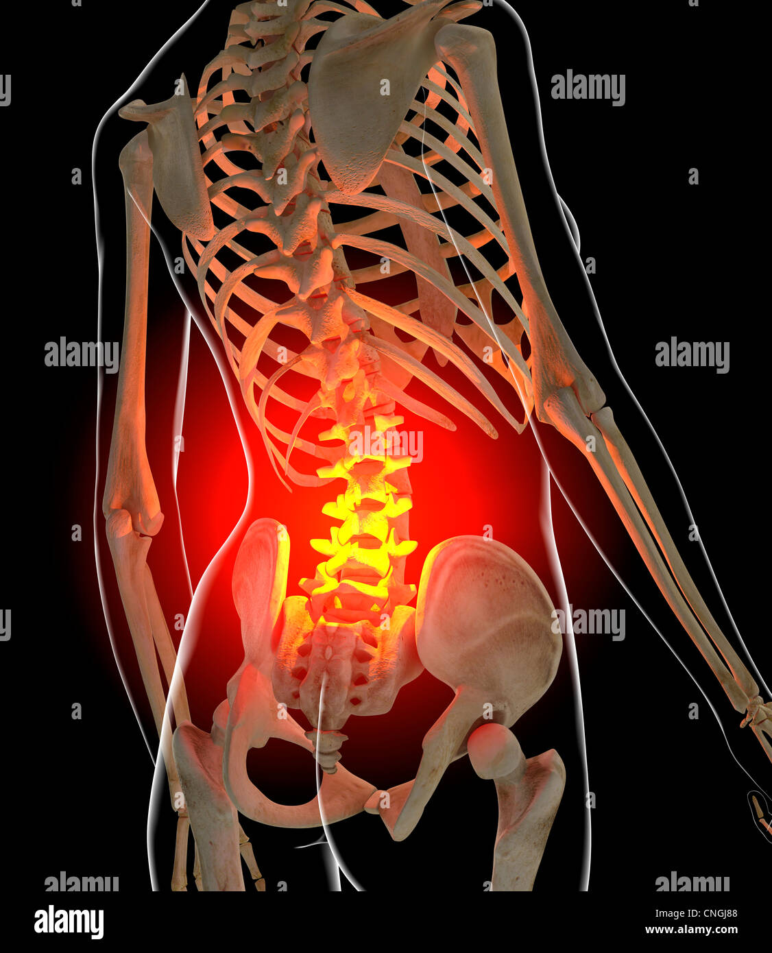 Back pain conceptual artwork Stock Photo - Alamy