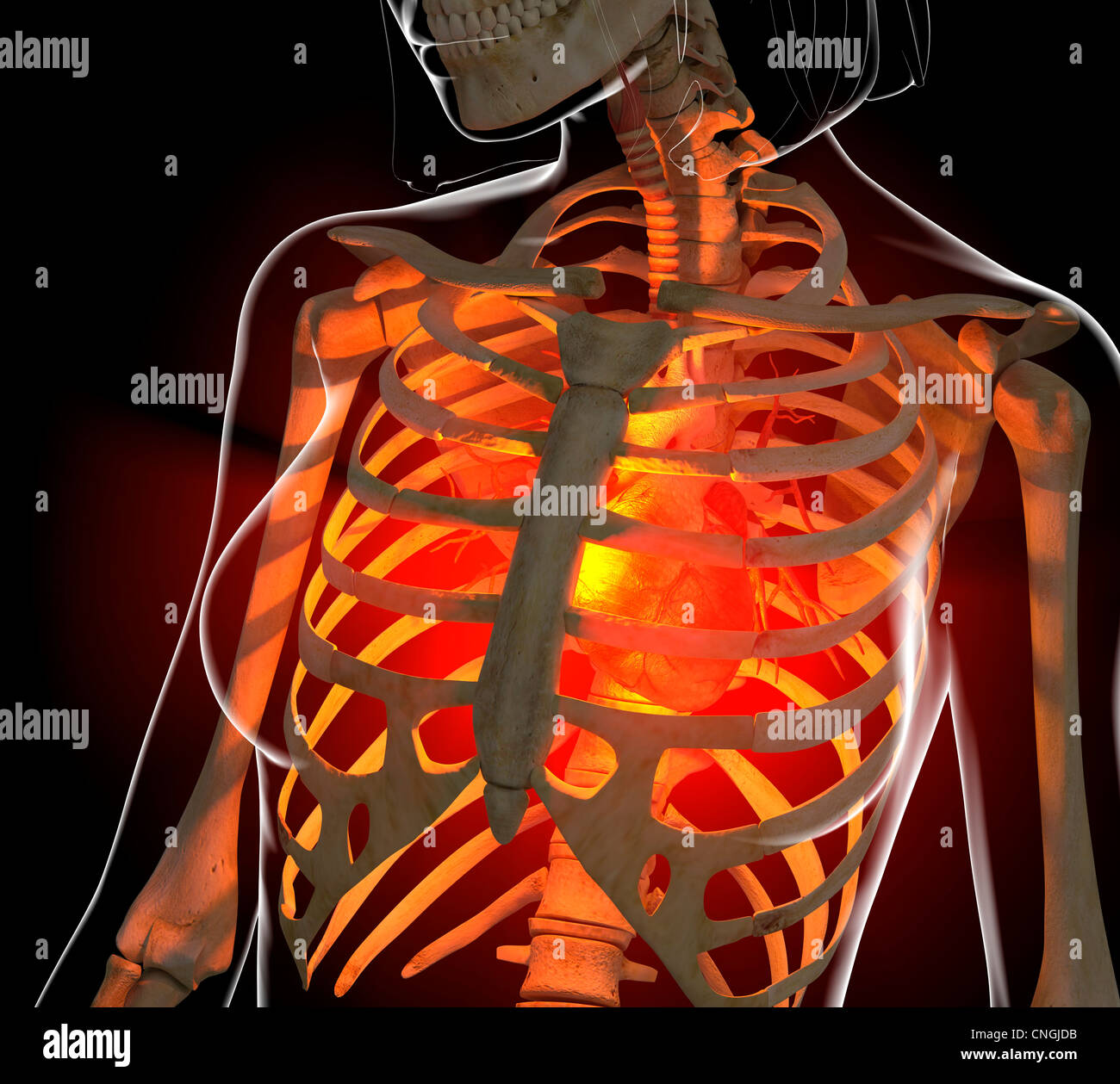 Angina conceptual artwork Stock Photo - Alamy