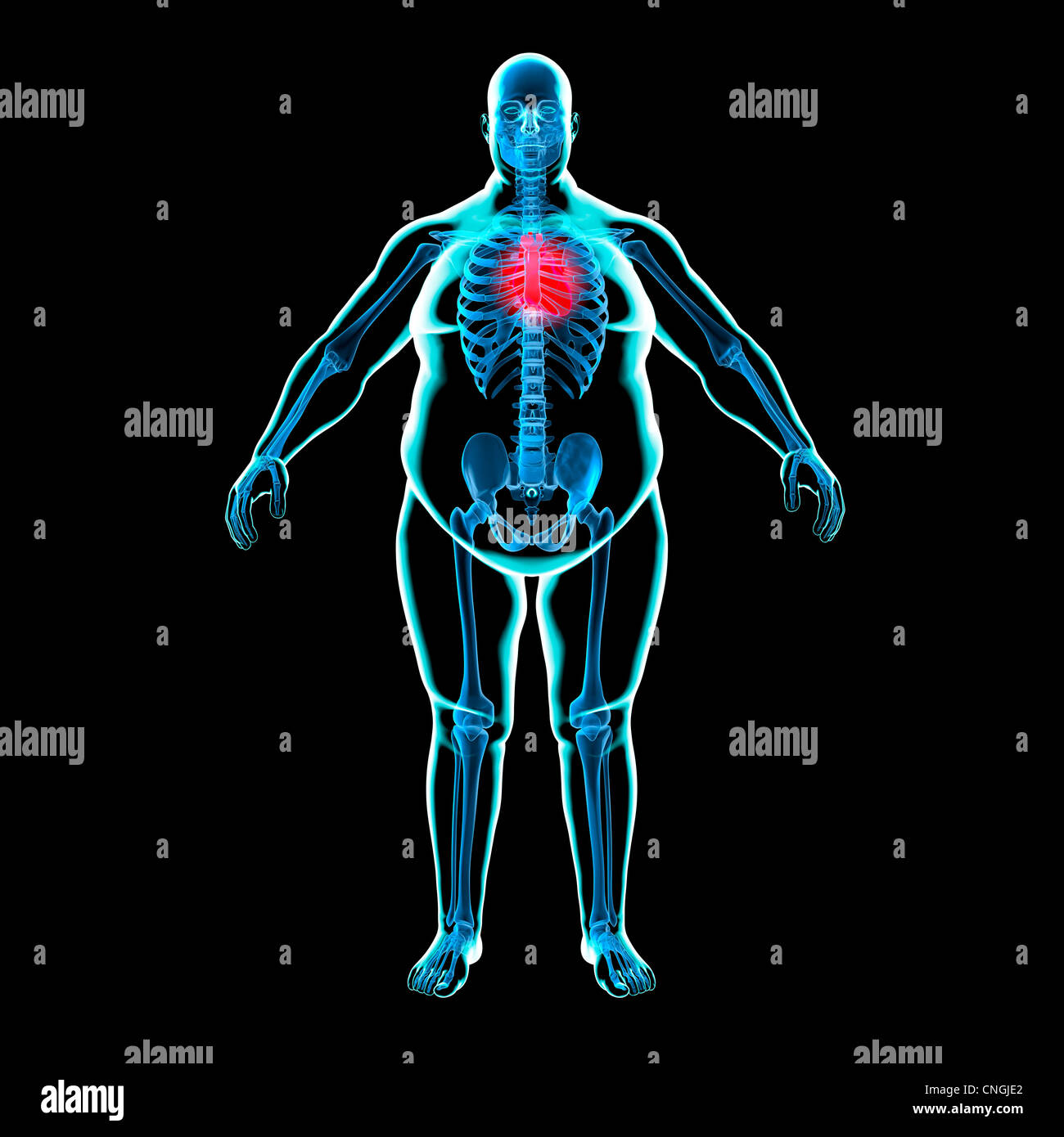Heart illnesses hi-res stock photography and images - Alamy