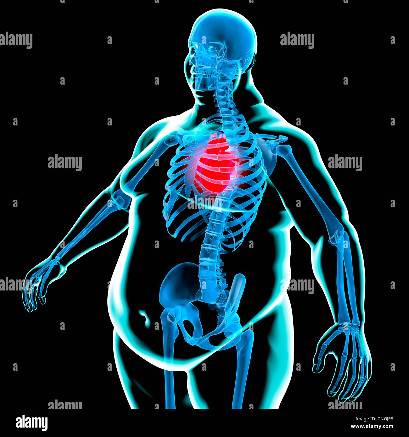 Obese man's heart artwork Stock Photo - Alamy