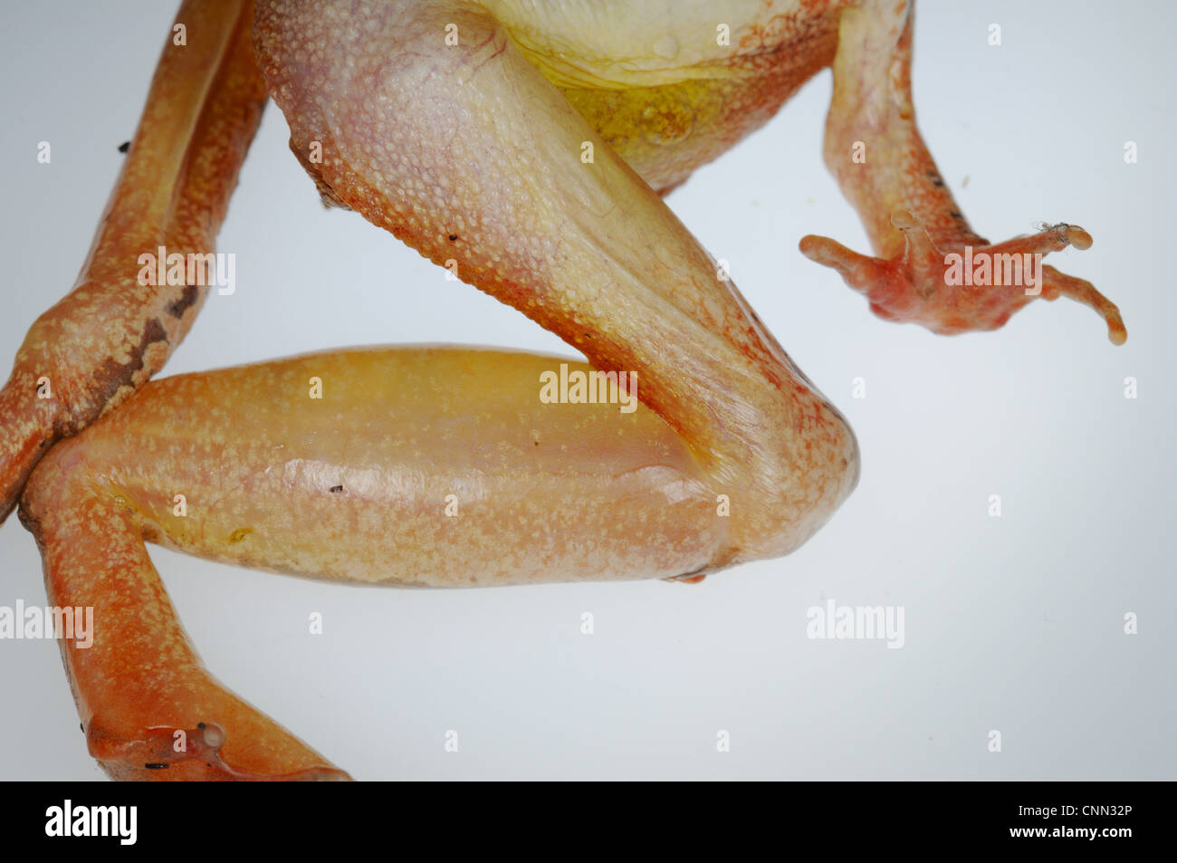 Fungal skin infections hi-res stock photography and images - Alamy