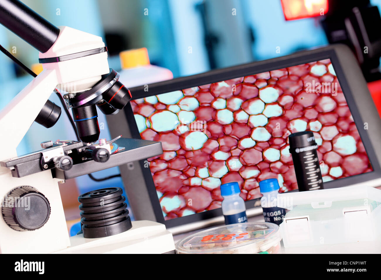 Test biopsy c on microscope for cancer cells Stock Photo - Alamy