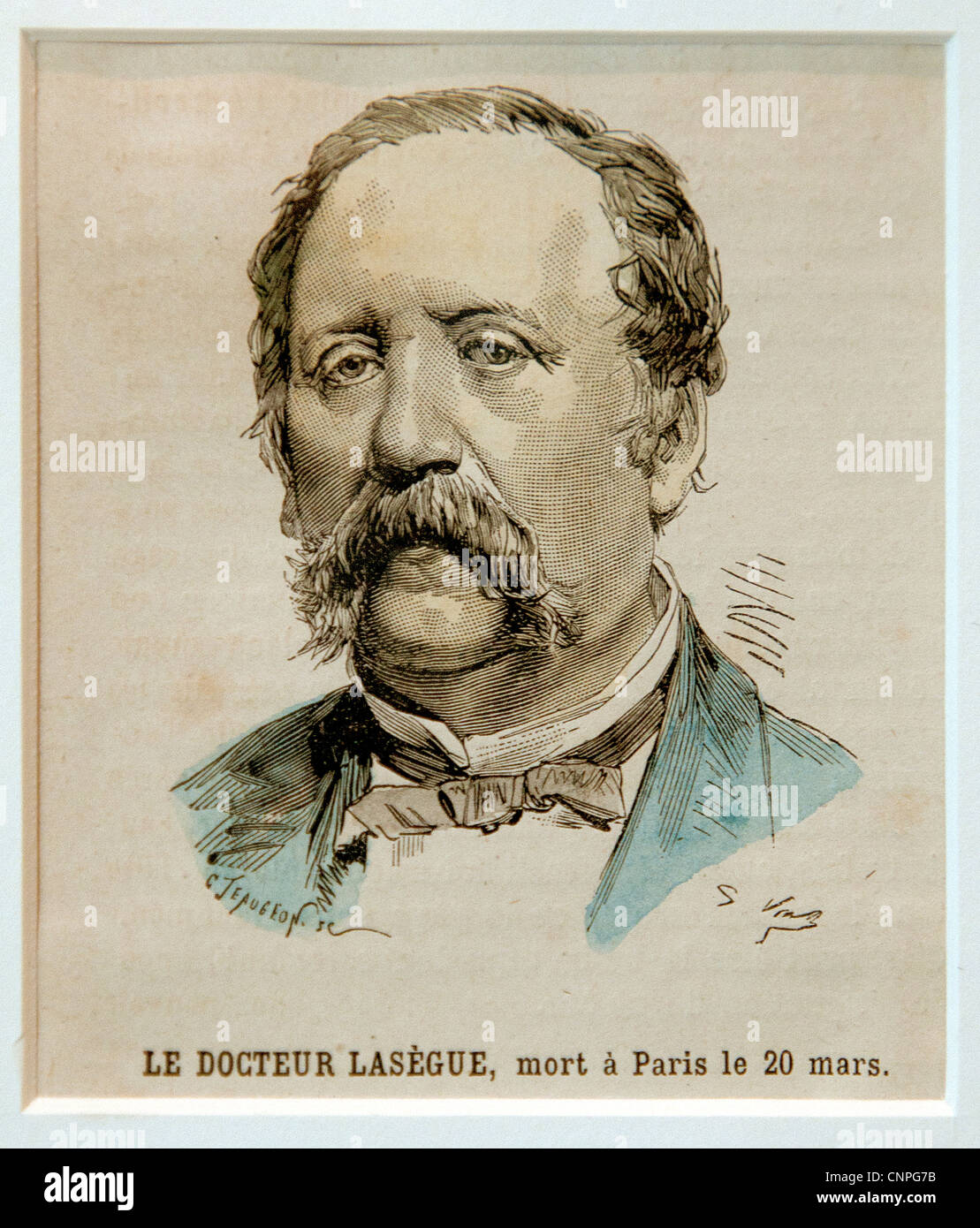 Lasegue hi-res stock photography and images - Alamy