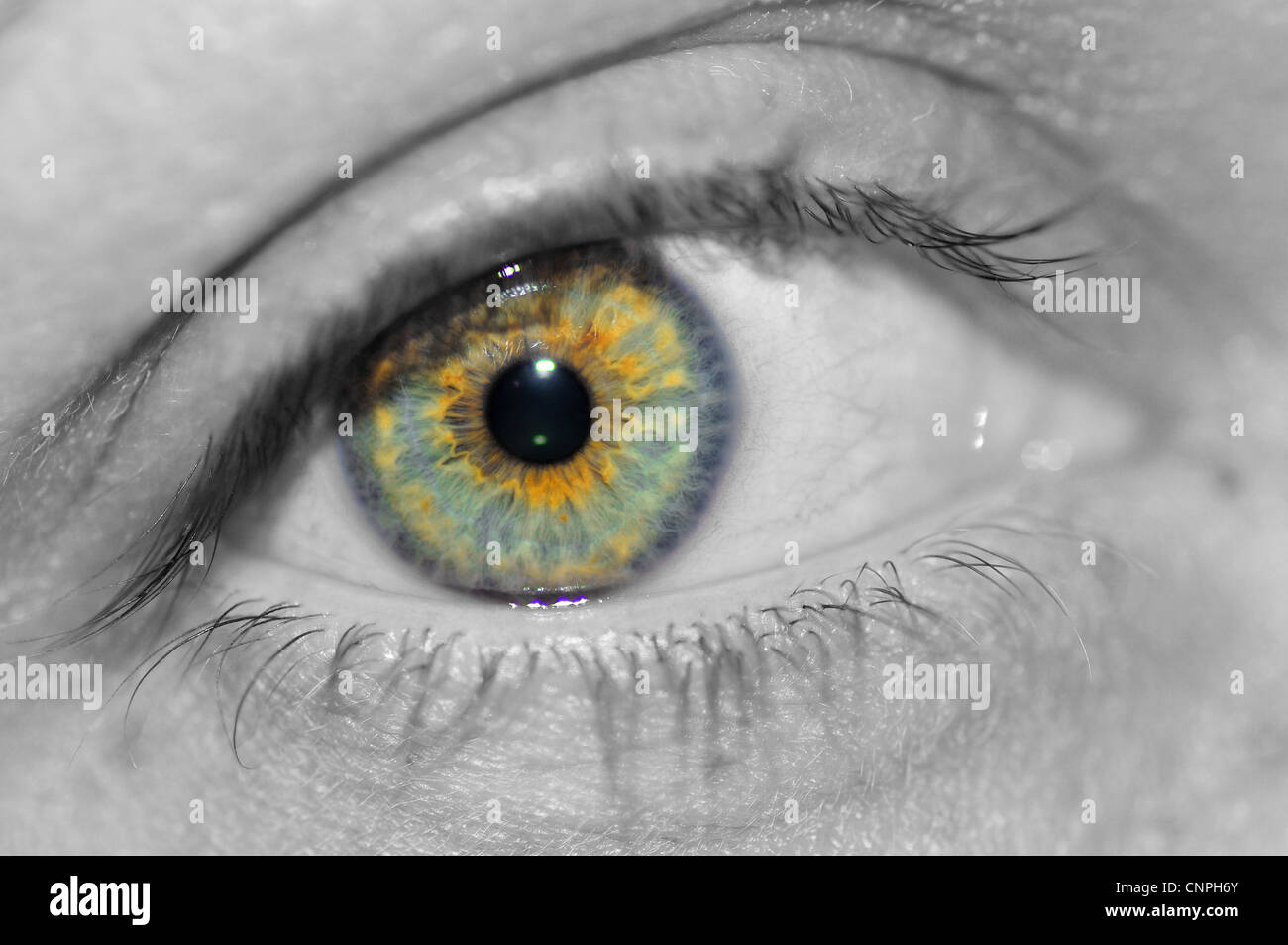 Phlebitis hi-res stock photography and images - Alamy