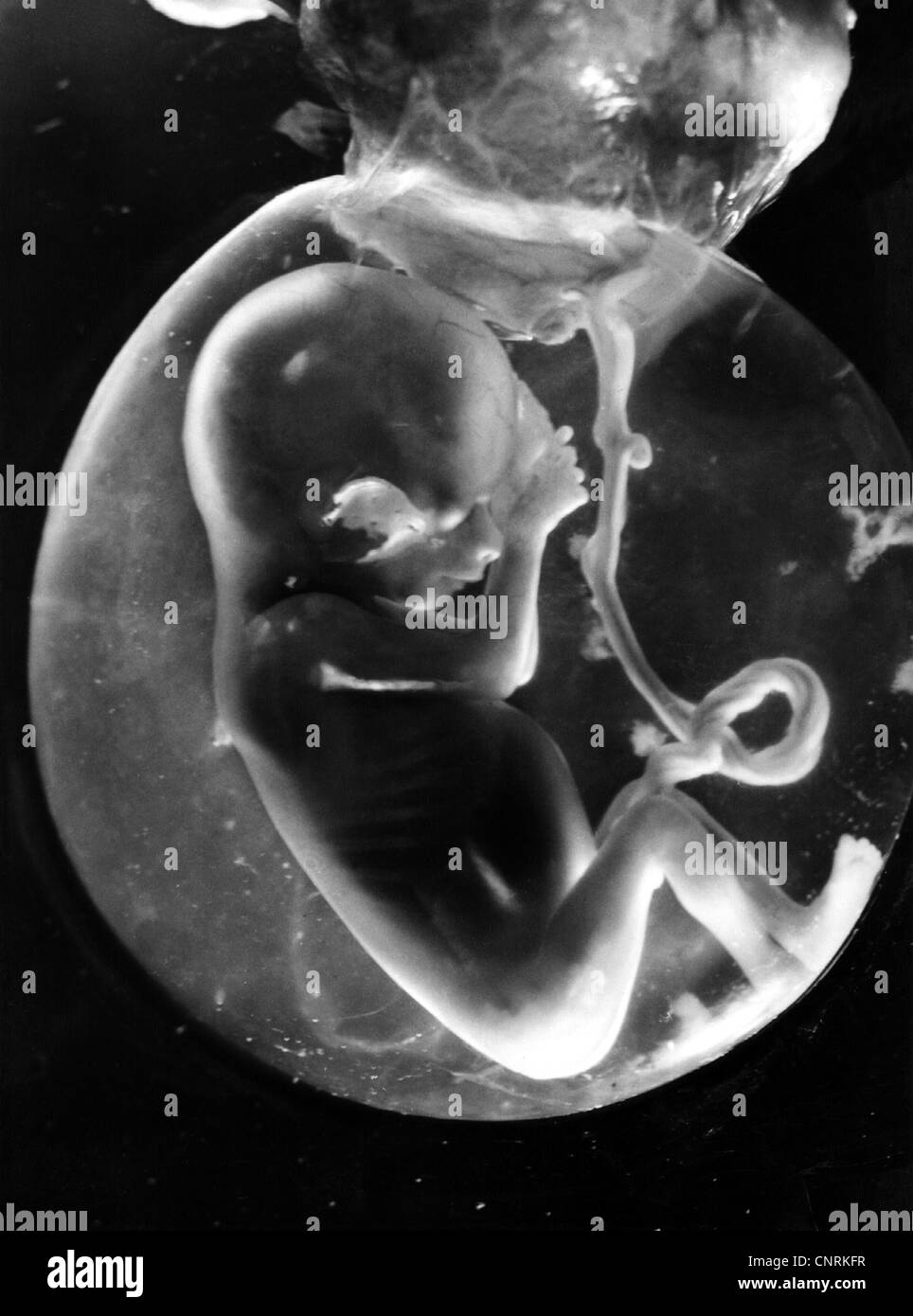 Uterus Black and White Stock Photos & Images - Alamy