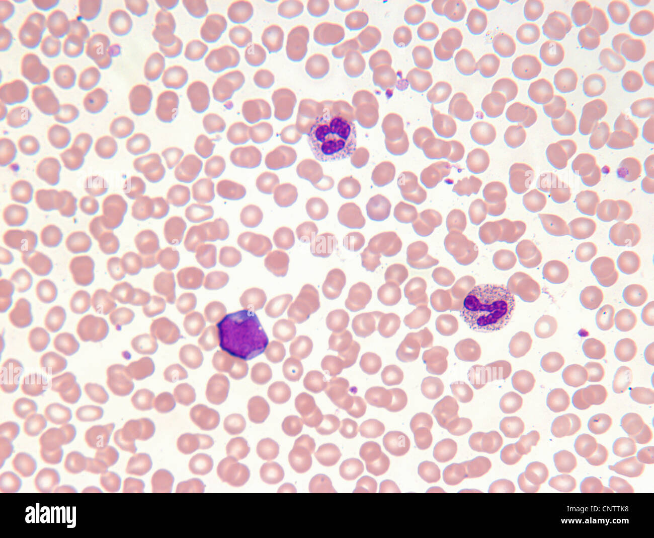 Blood smear cell hi-res stock photography and images - Alamy