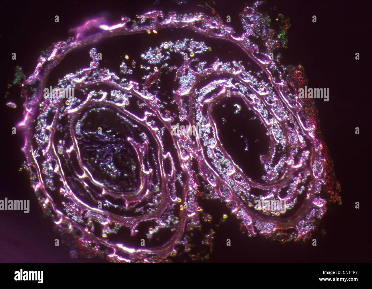 Human feces hi-res stock photography and images - Alamy