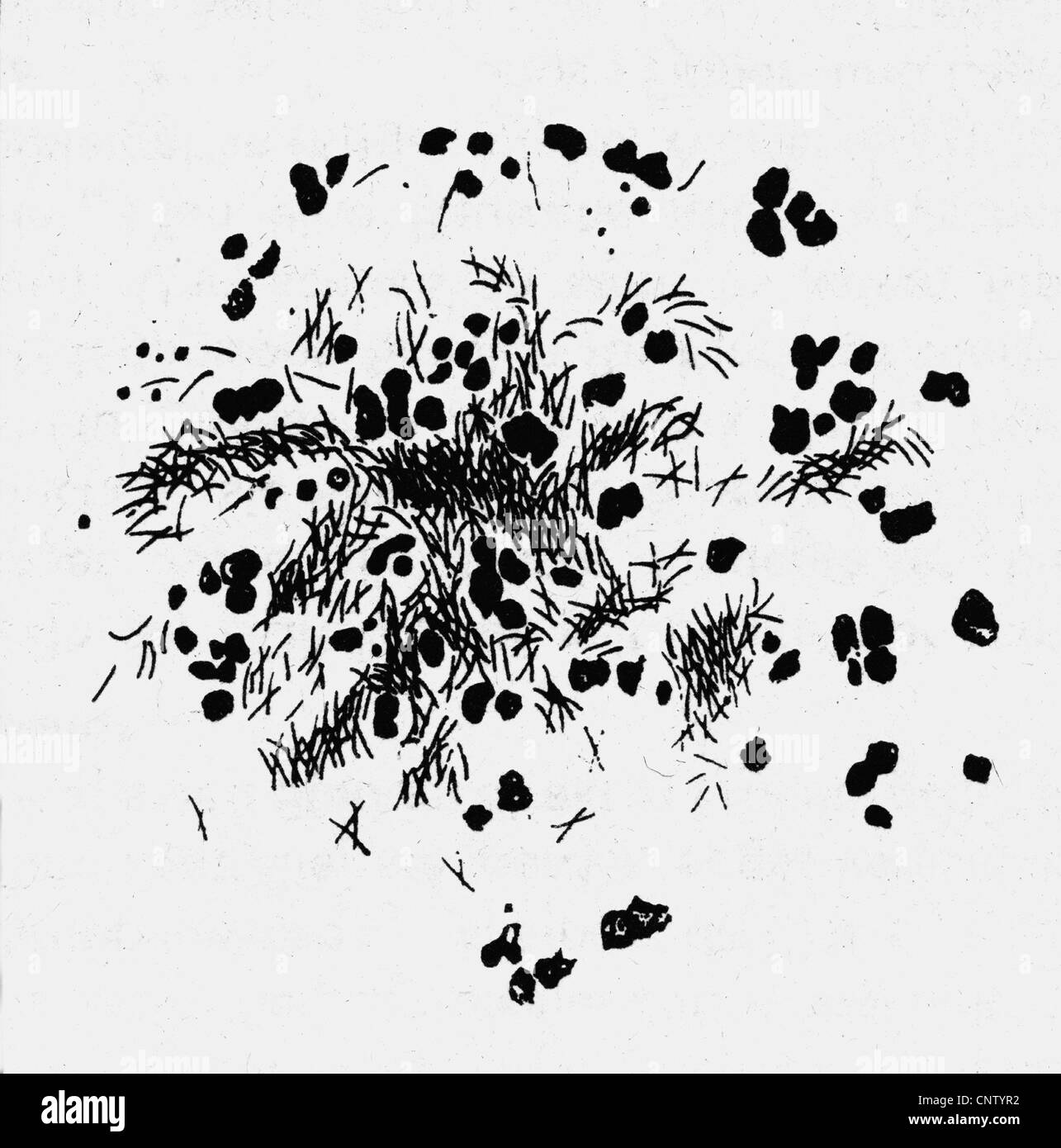 Tuberculosis drawing Black and White Stock Photos & Images - Alamy