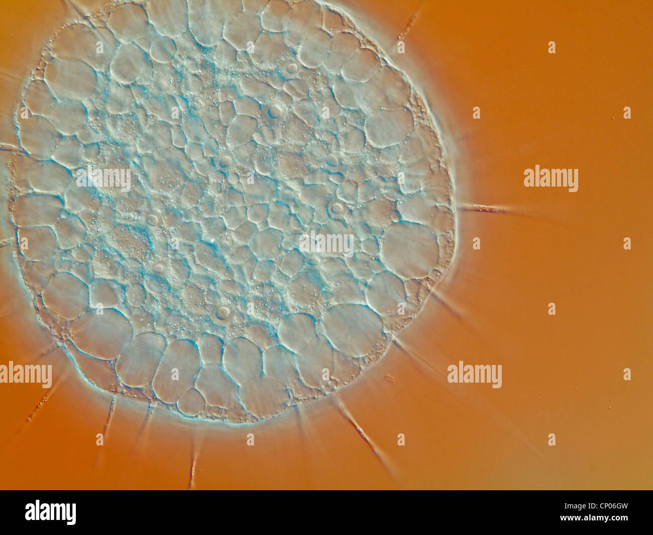 Actinosphaerium eichhorni (Actinosphaerium eichhorni), with many ...