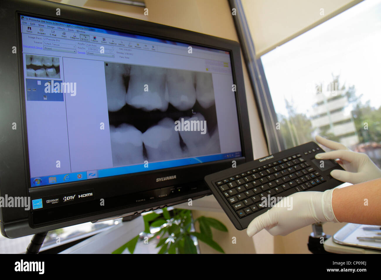 X Ray Of Teeth High Resolution Stock Photography and Images - Alamy