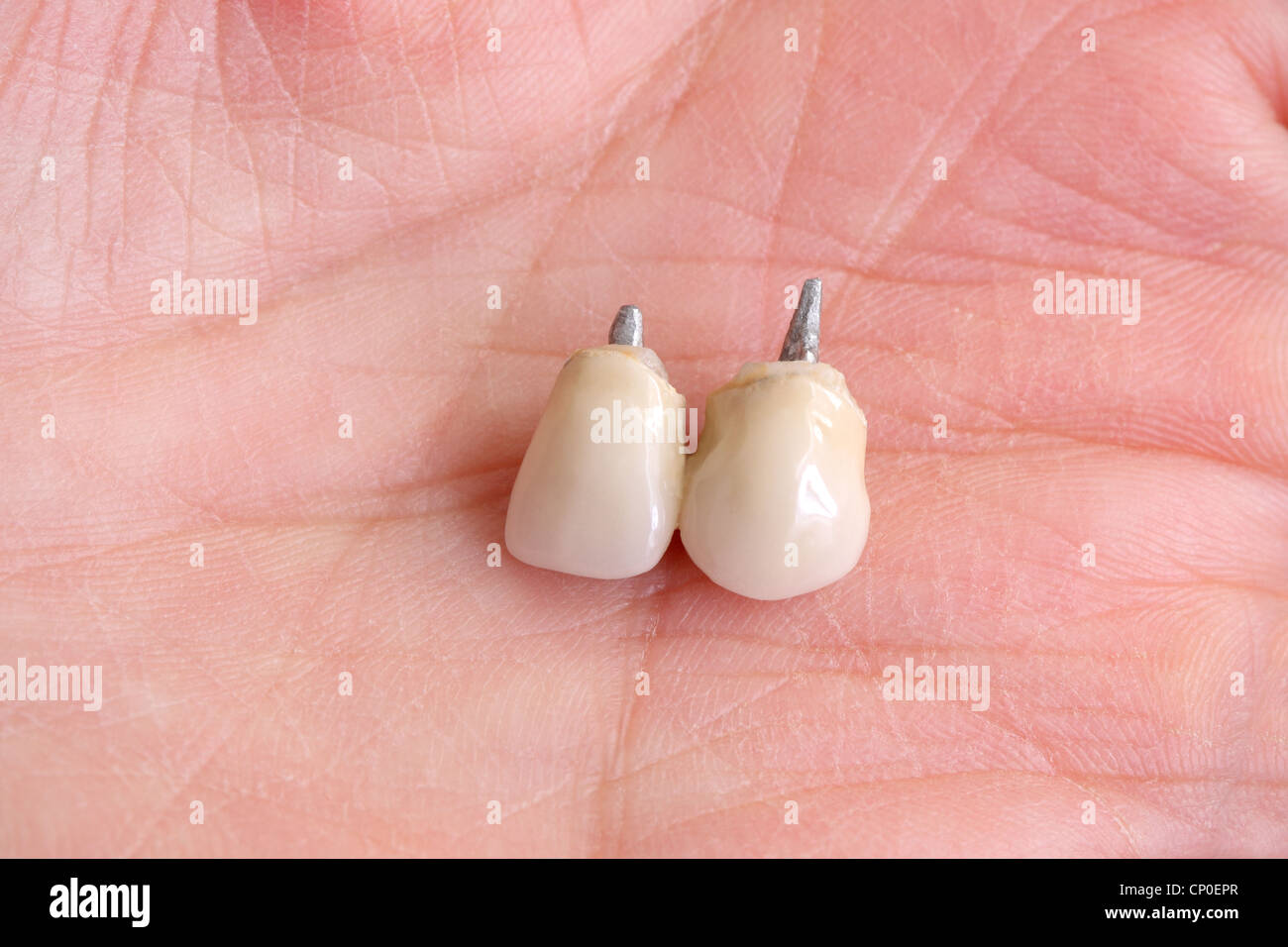 Protetic hi-res stock photography and images - Alamy