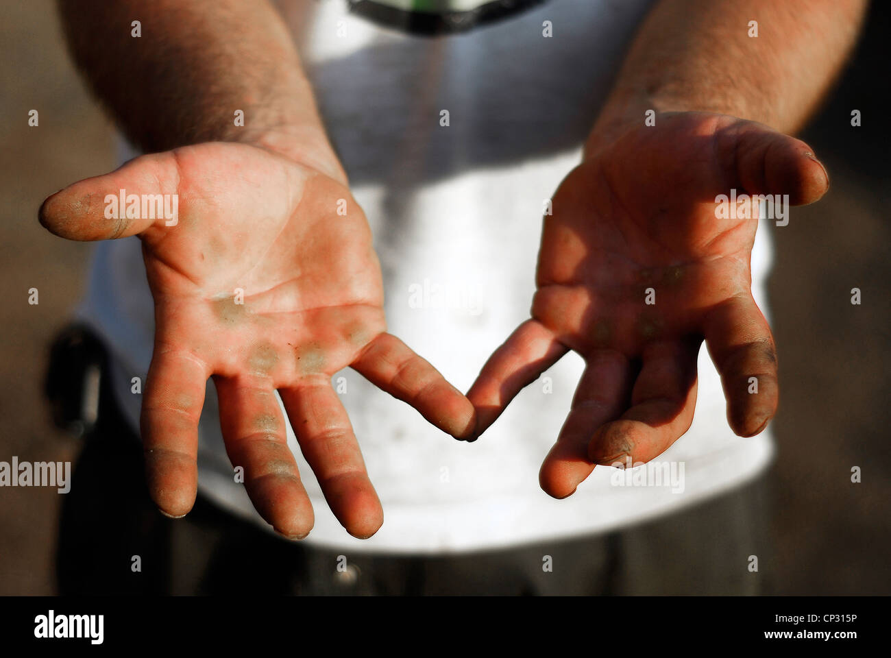 hands, manual, callus Stock Photo - Alamy