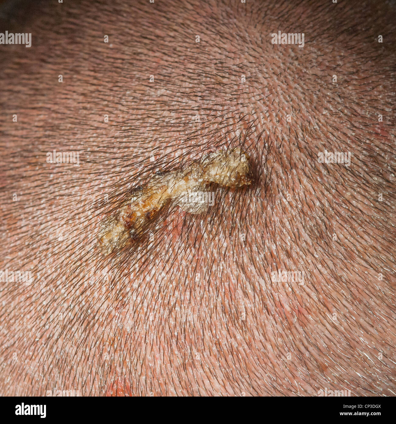 Scar head hi-res stock photography and images - Alamy
