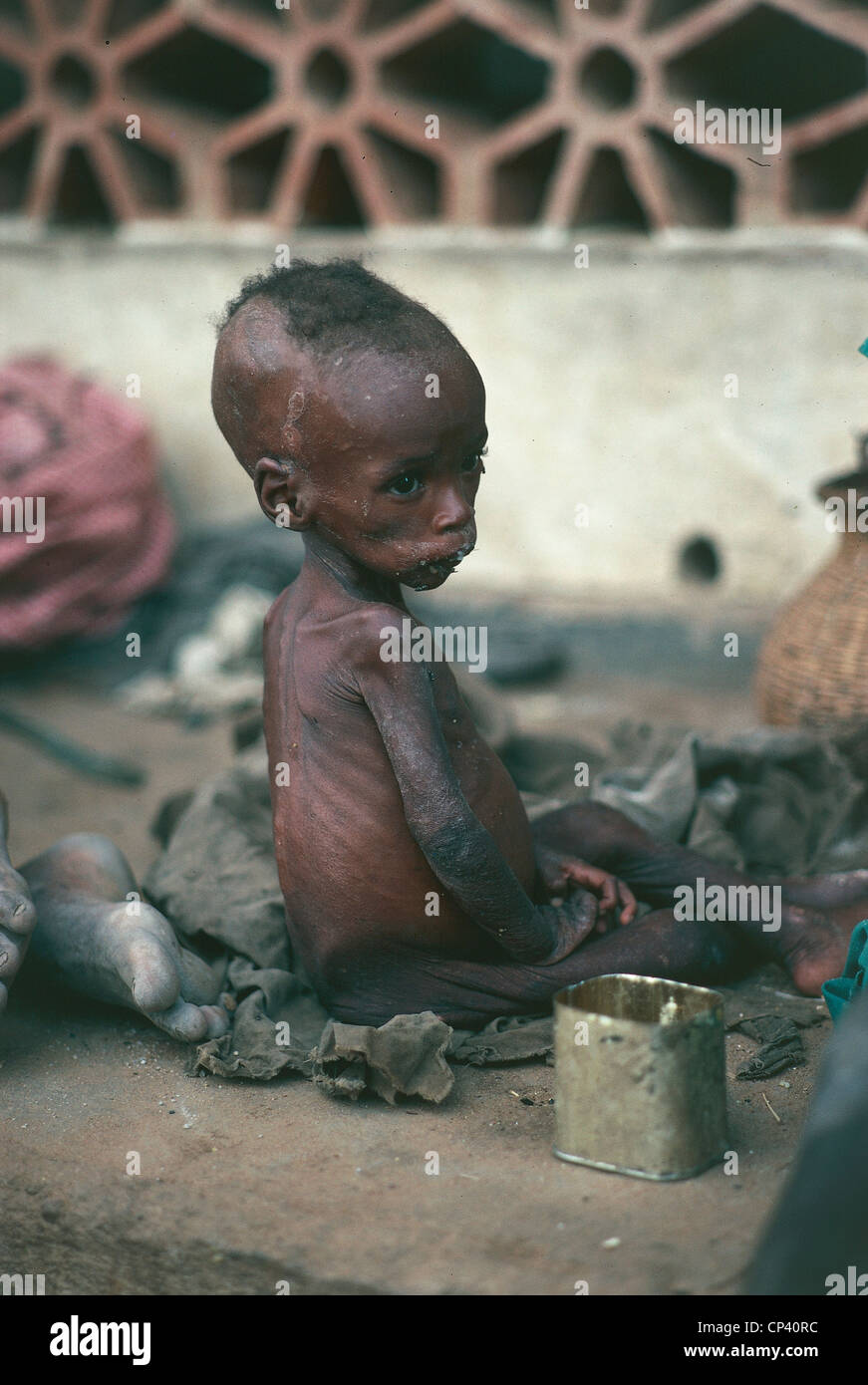 Uganda, undernourished child Stock Photo - Alamy