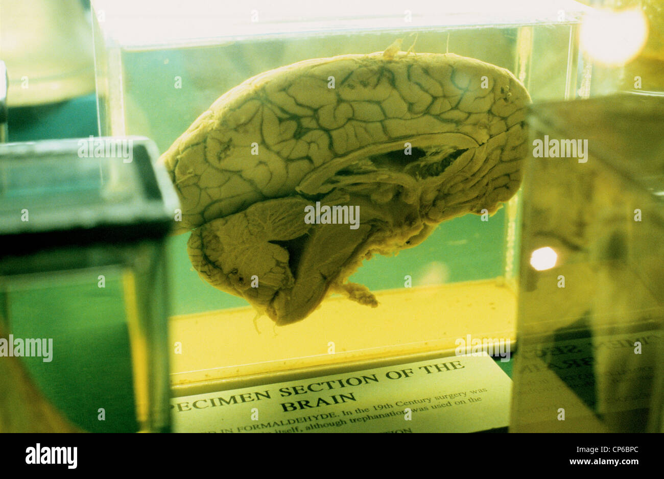 A human brain in a medical museum Stock Photo - Alamy