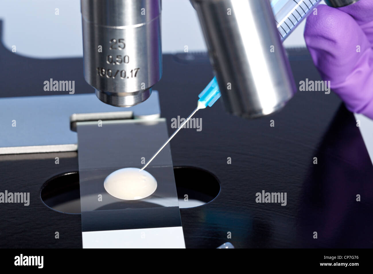 Photo of a sperm sample on a microscope slide with a syringe being used ...