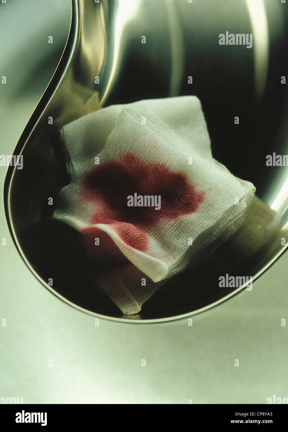 Gauze bandage with blood stain in kidney dish Stock Photo - Alamy