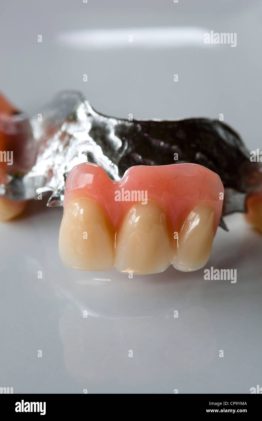 False Teeth or Dentures Stock Photo - Alamy