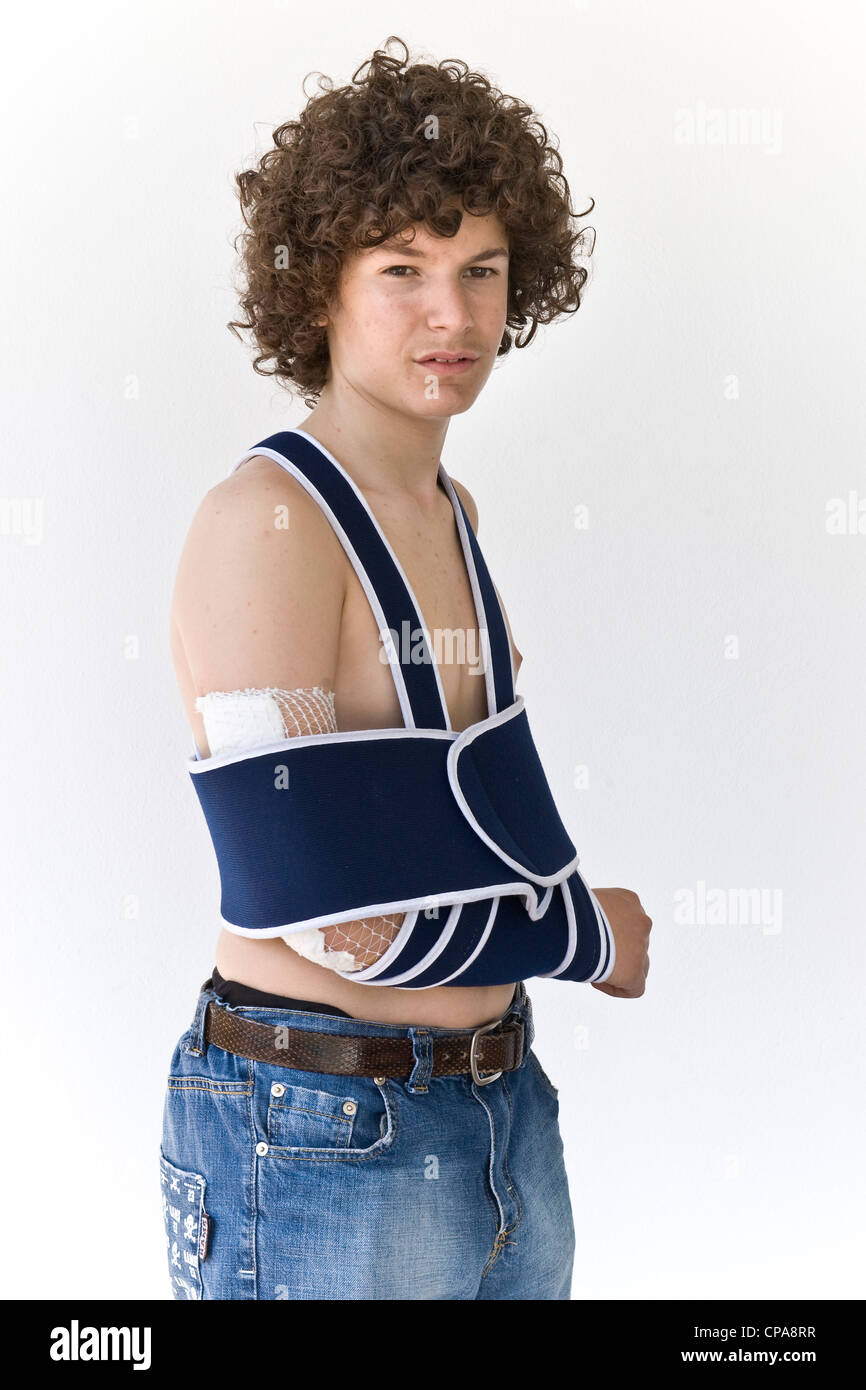 Broken Shoulder Blade Cast