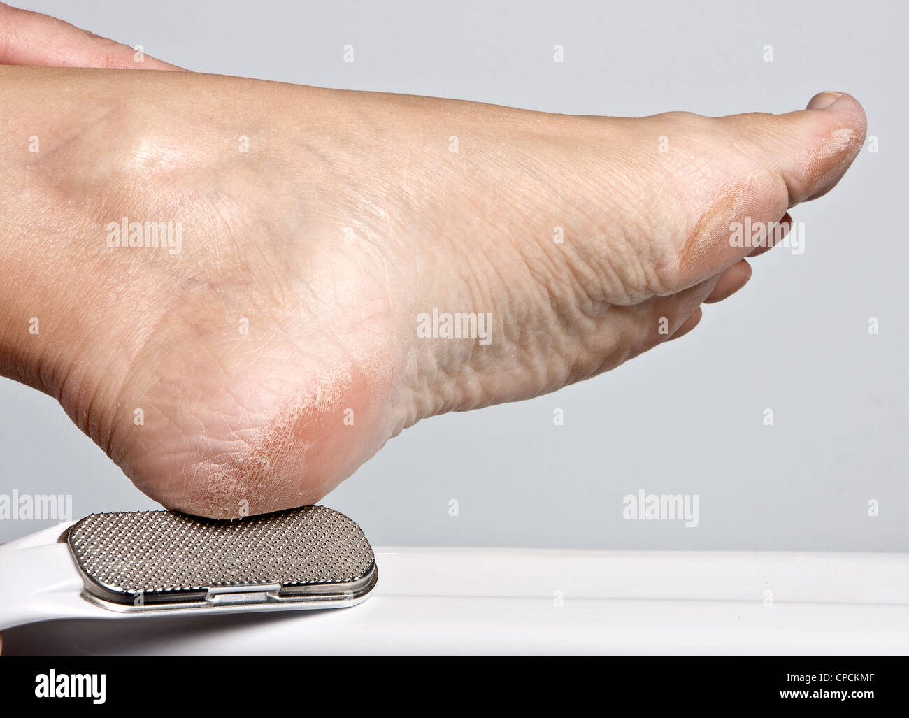 Hand removing callous from a dry foot Stock Photo - Alamy