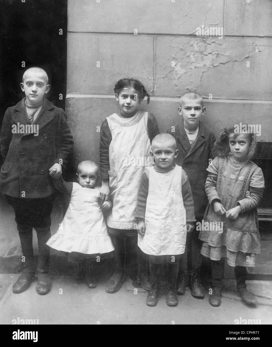 Rickets disease hi-res stock photography and images - Alamy