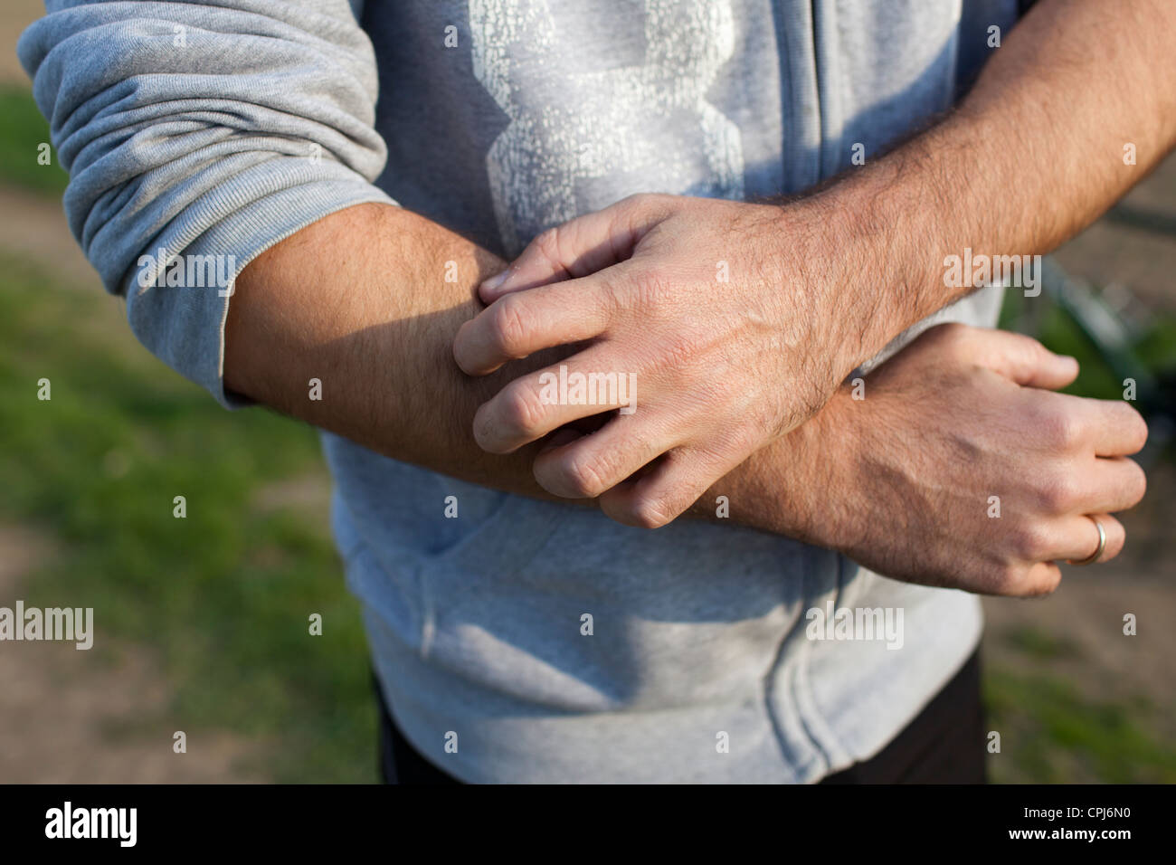 Scratching Arm Stock Photos & Scratching Arm Stock Images - Alamy