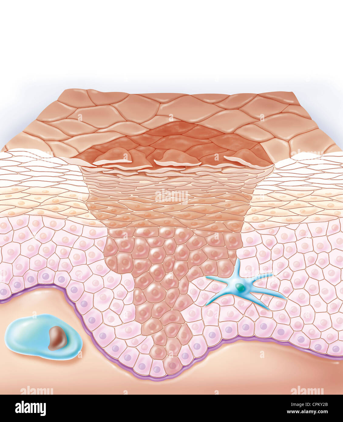 Keratinized hi-res stock photography and images - Alamy