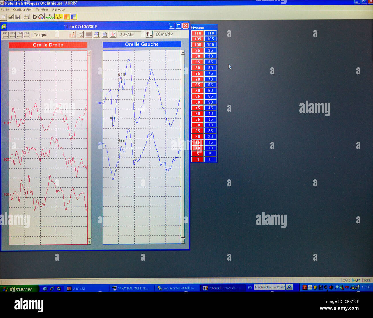 Audiometry Test High Resolution Stock Photography and Images - Alamy
