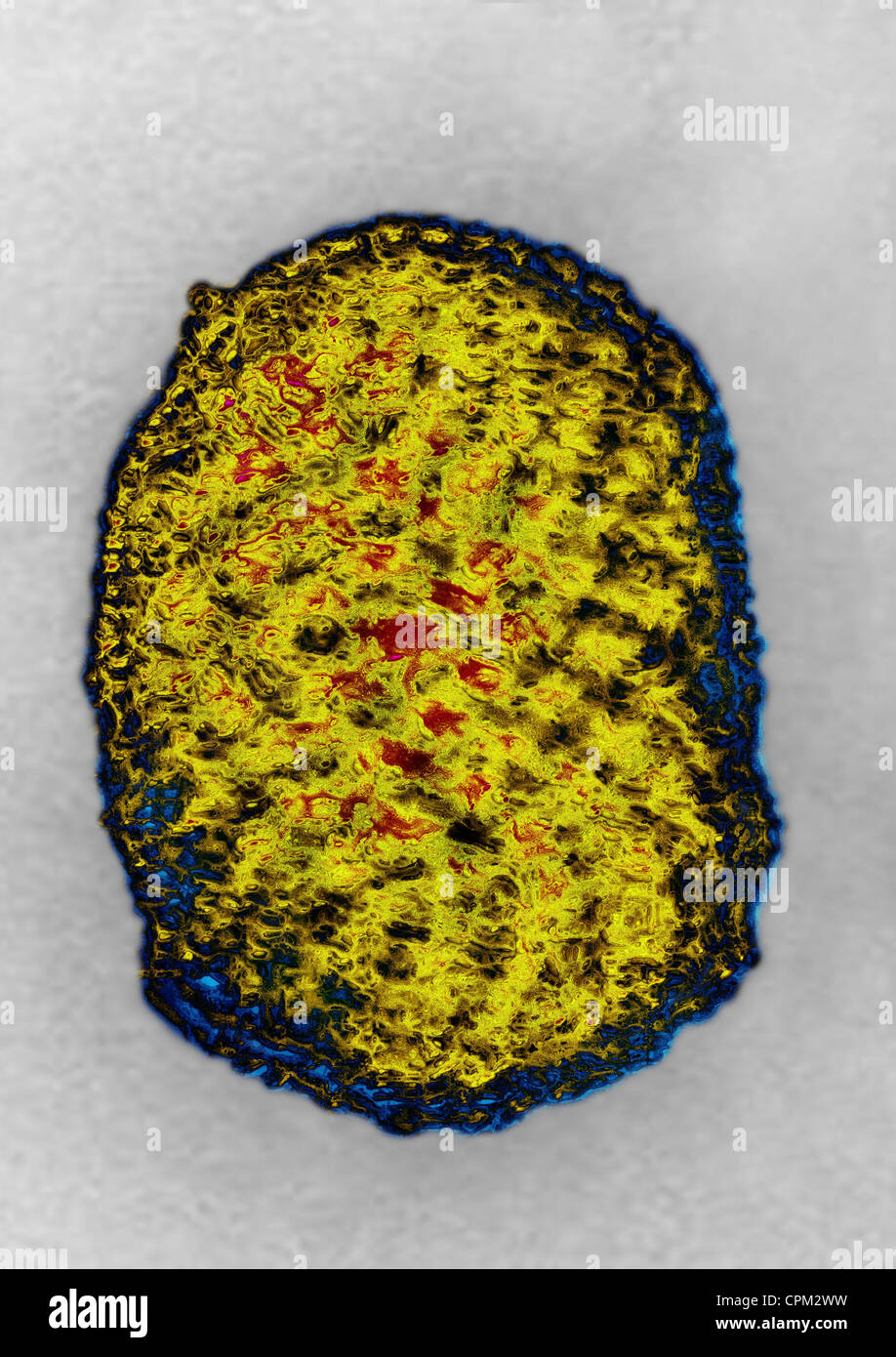 Virus pox hi-res stock photography and images - Alamy