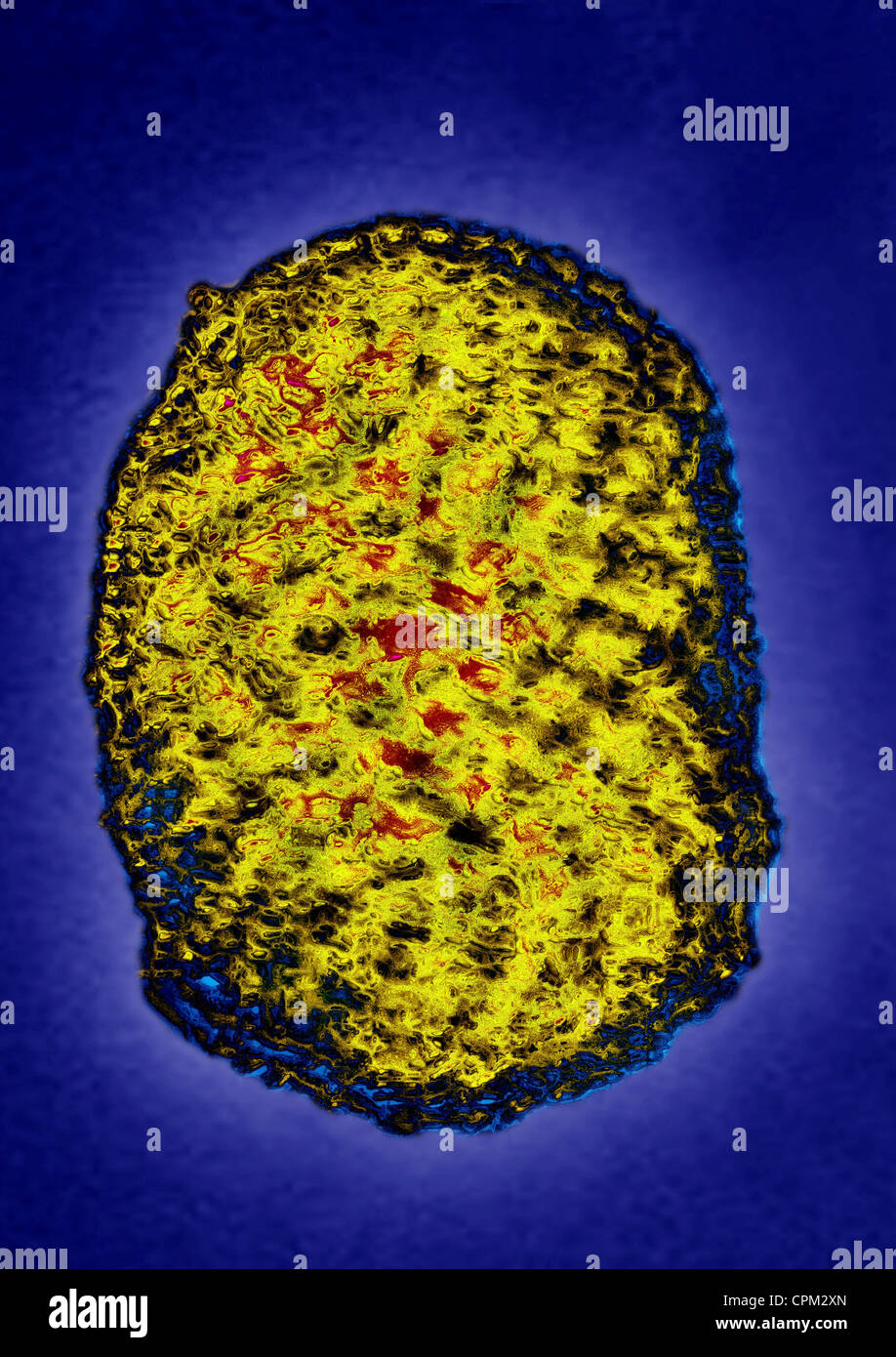 Poxviridae High Resolution Stock Photography and Images - Alamy