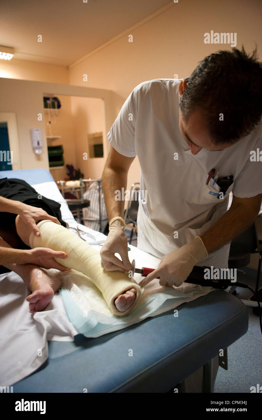 Leg Casts Stock Photos & Leg Casts Stock Images - Alamy