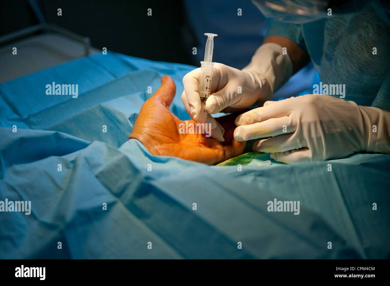 Fasciotomy hi-res stock photography and images - Alamy