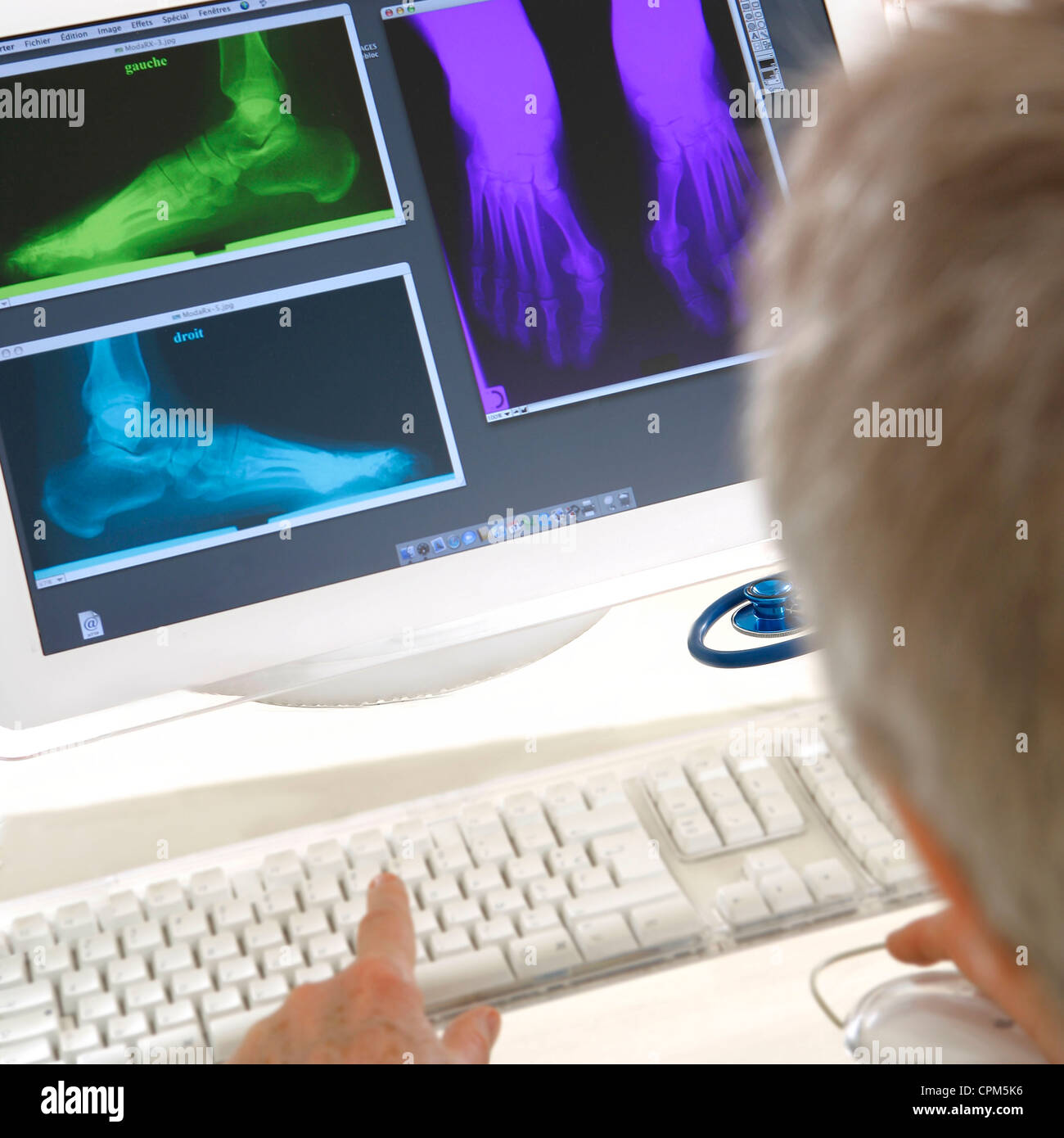 X ray consultation foot hi-res stock photography and images - Alamy
