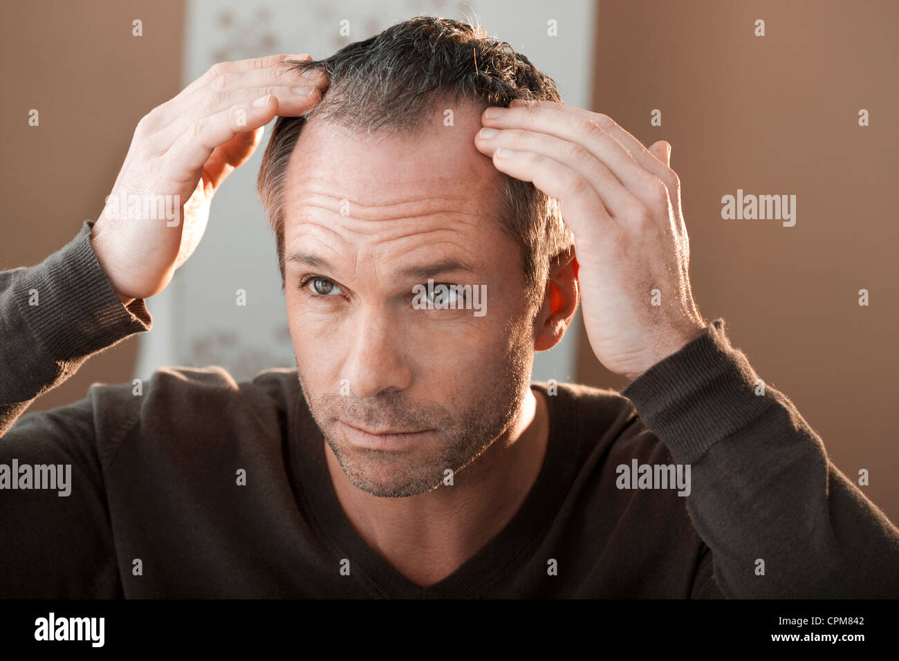 Alopecia men hi-res stock photography and images - Alamy