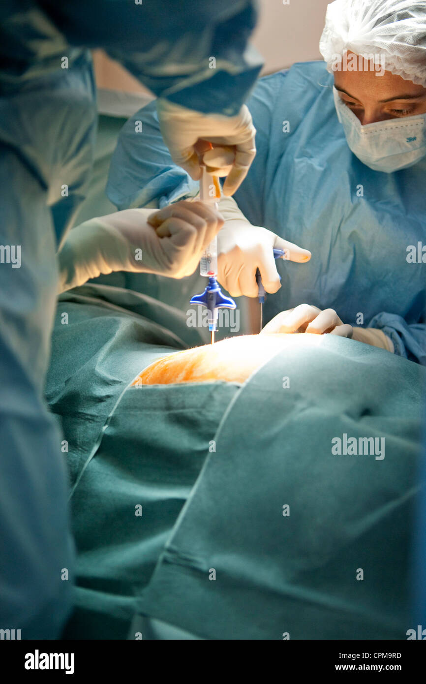 Bone marrow biopsy hi-res stock photography and images - Alamy