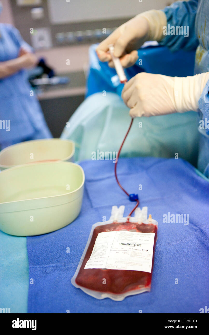 BONE MARROW ASPIRATION Stock Photo - Alamy