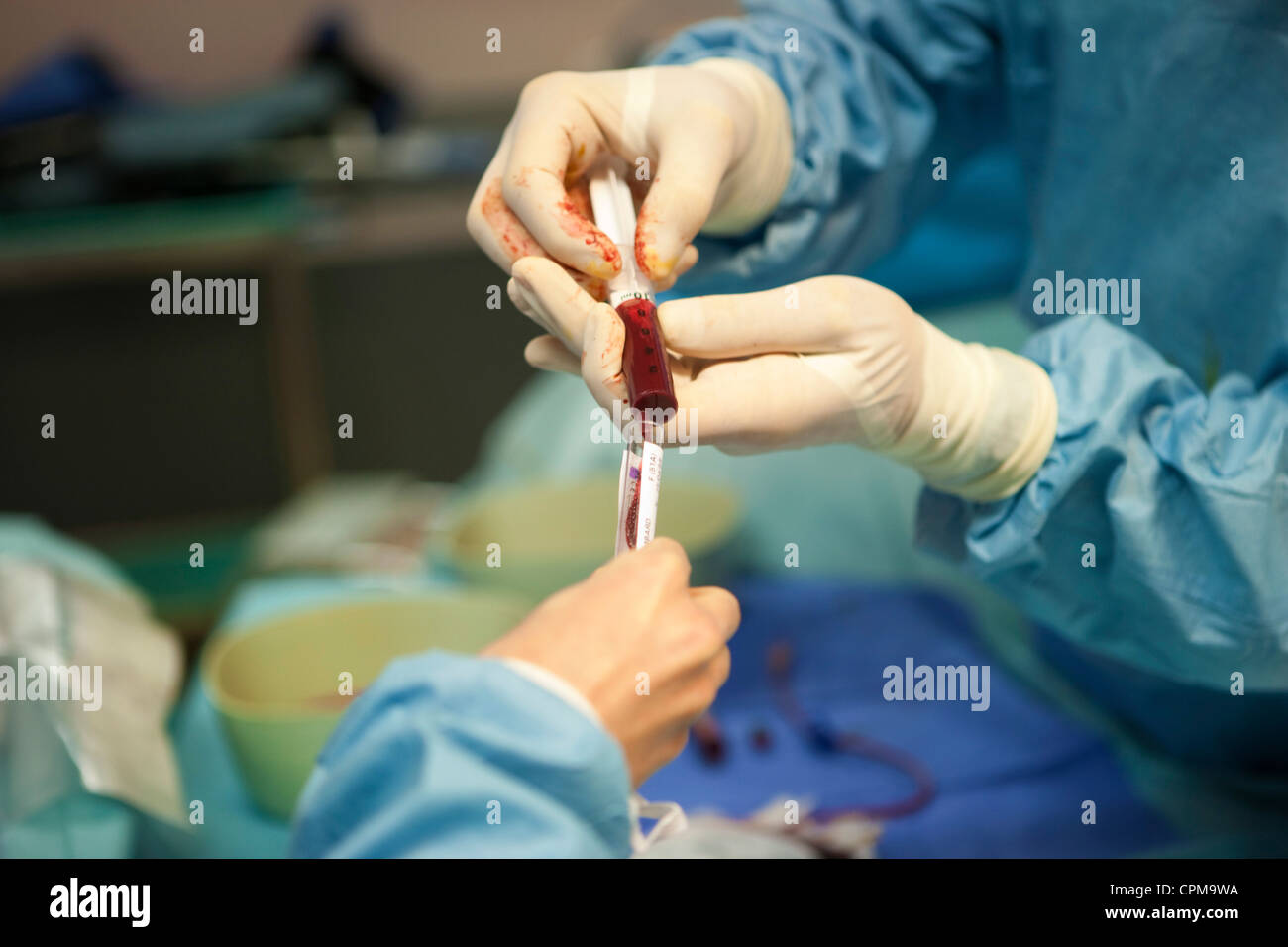 Bone marrow test hi-res stock photography and images - Alamy