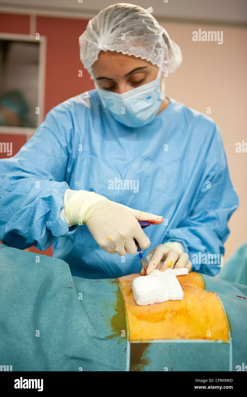 Bone marrow biopsy hi-res stock photography and images - Alamy