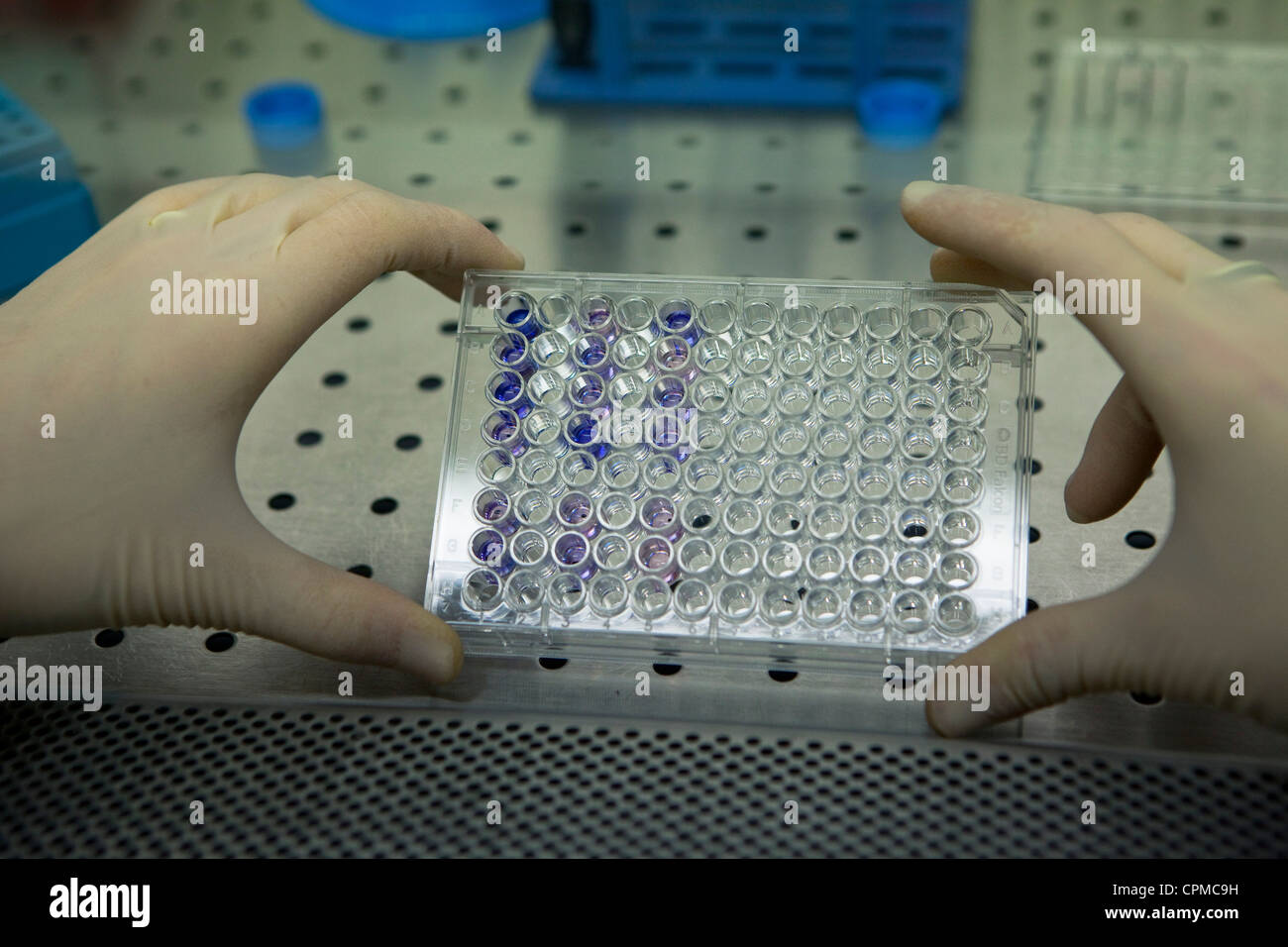 Elisa test hi-res stock photography and images - Alamy