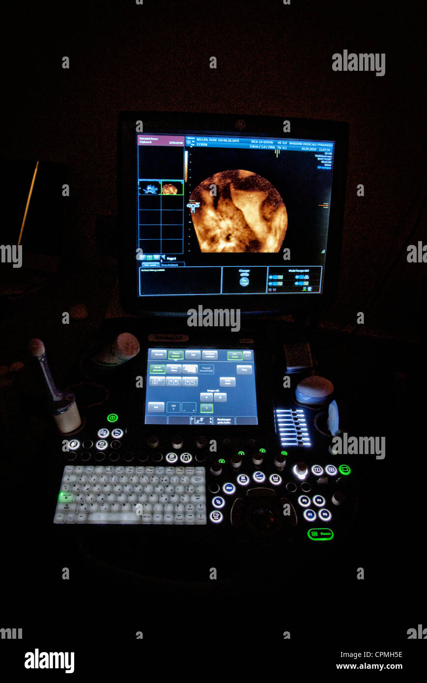 Ovaries ovary hi-res stock photography and images - Alamy
