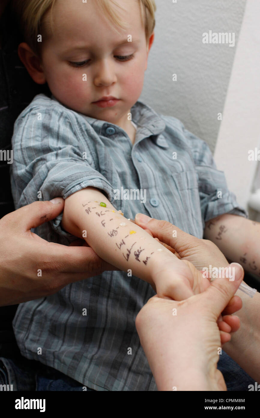 ALLERGY TEST, CHILD Stock Photo - Alamy