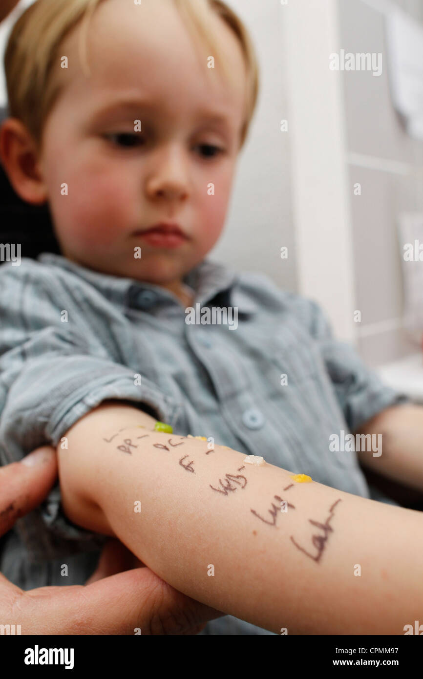 ALLERGY TEST, CHILD Stock Photo - Alamy