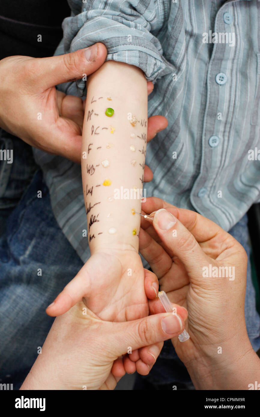 Allergy test at the arm hi-res stock photography and images - Alamy