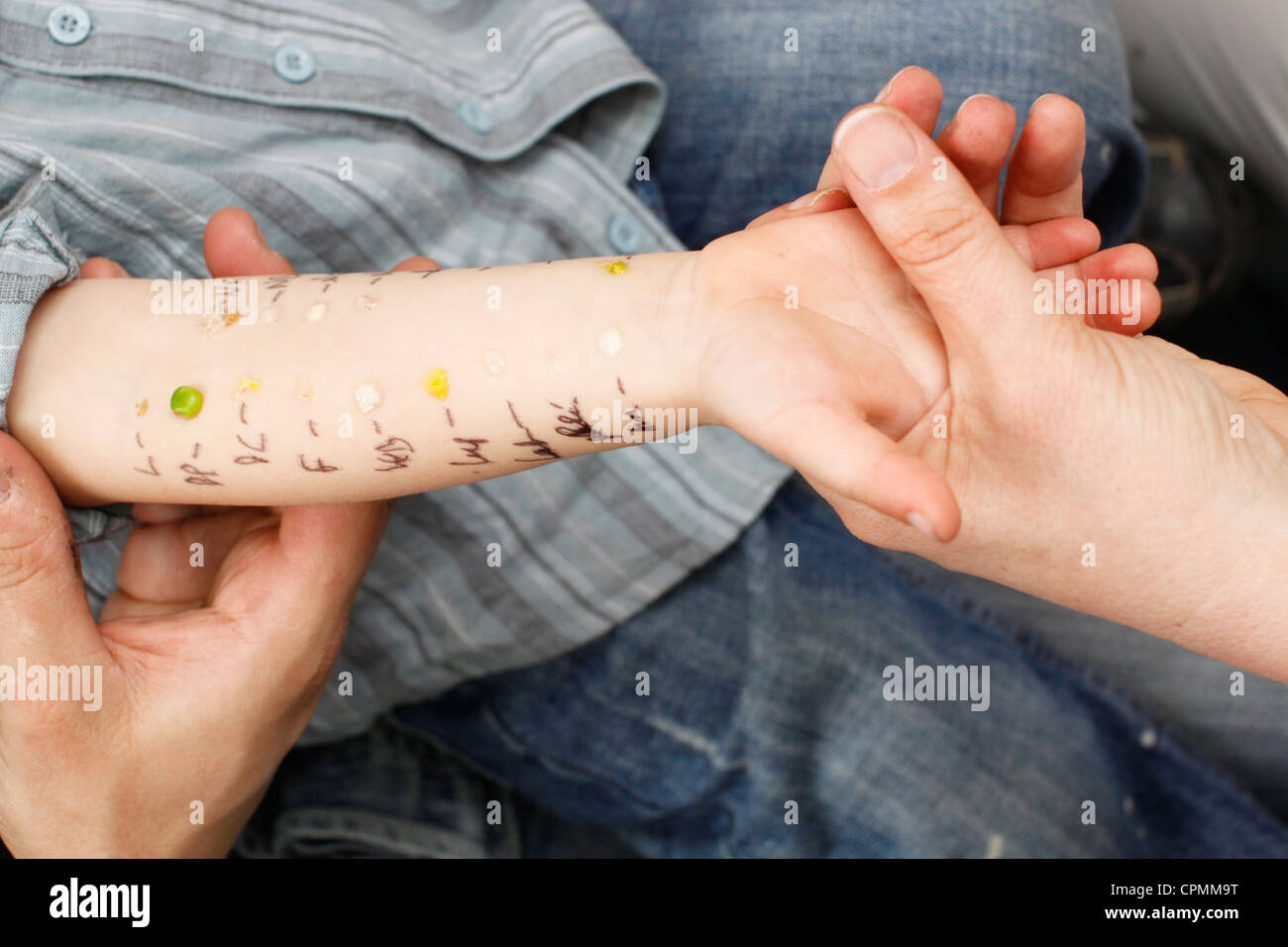 ALLERGY TEST, CHILD Stock Photo - Alamy