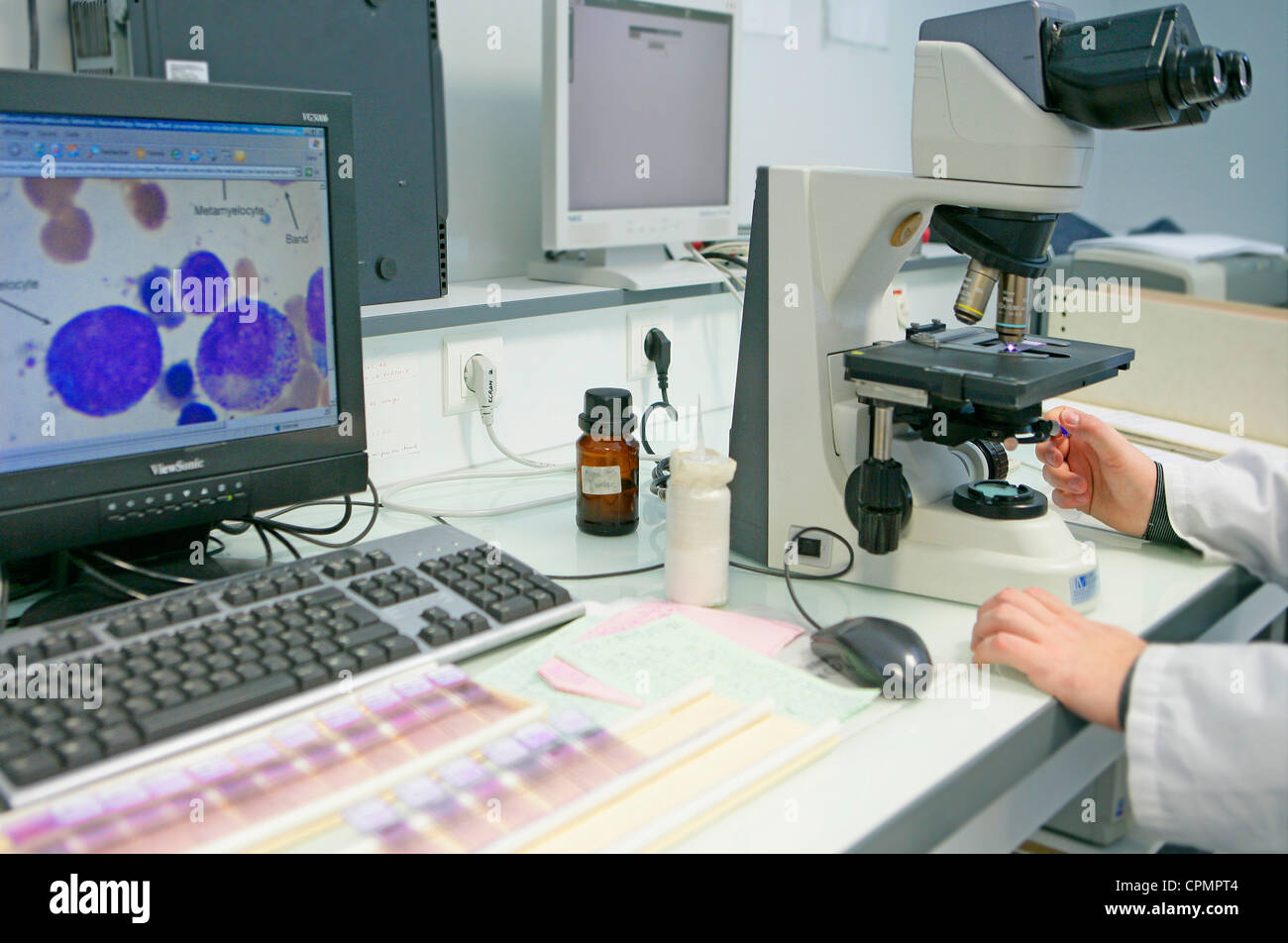 Peripheral blood smear hi-res stock photography and images - Alamy