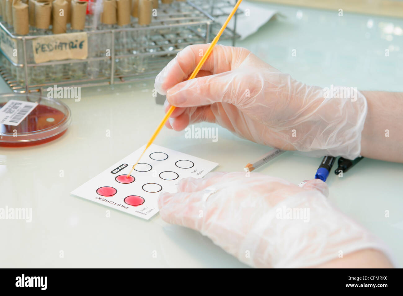 Immunologic tests hi-res stock photography and images - Alamy