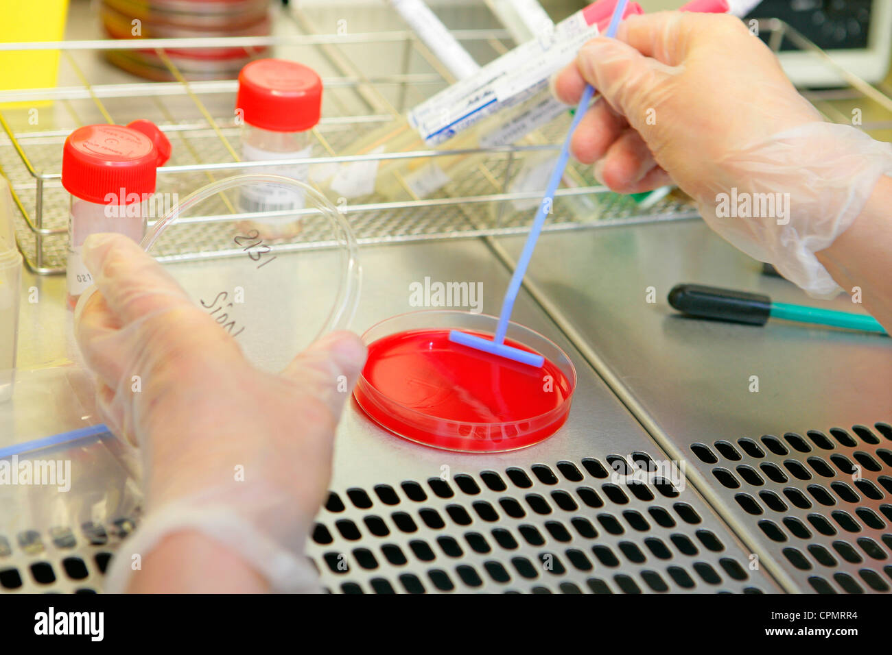 Samples Of Bacteria High Resolution Stock Photography and Images - Alamy