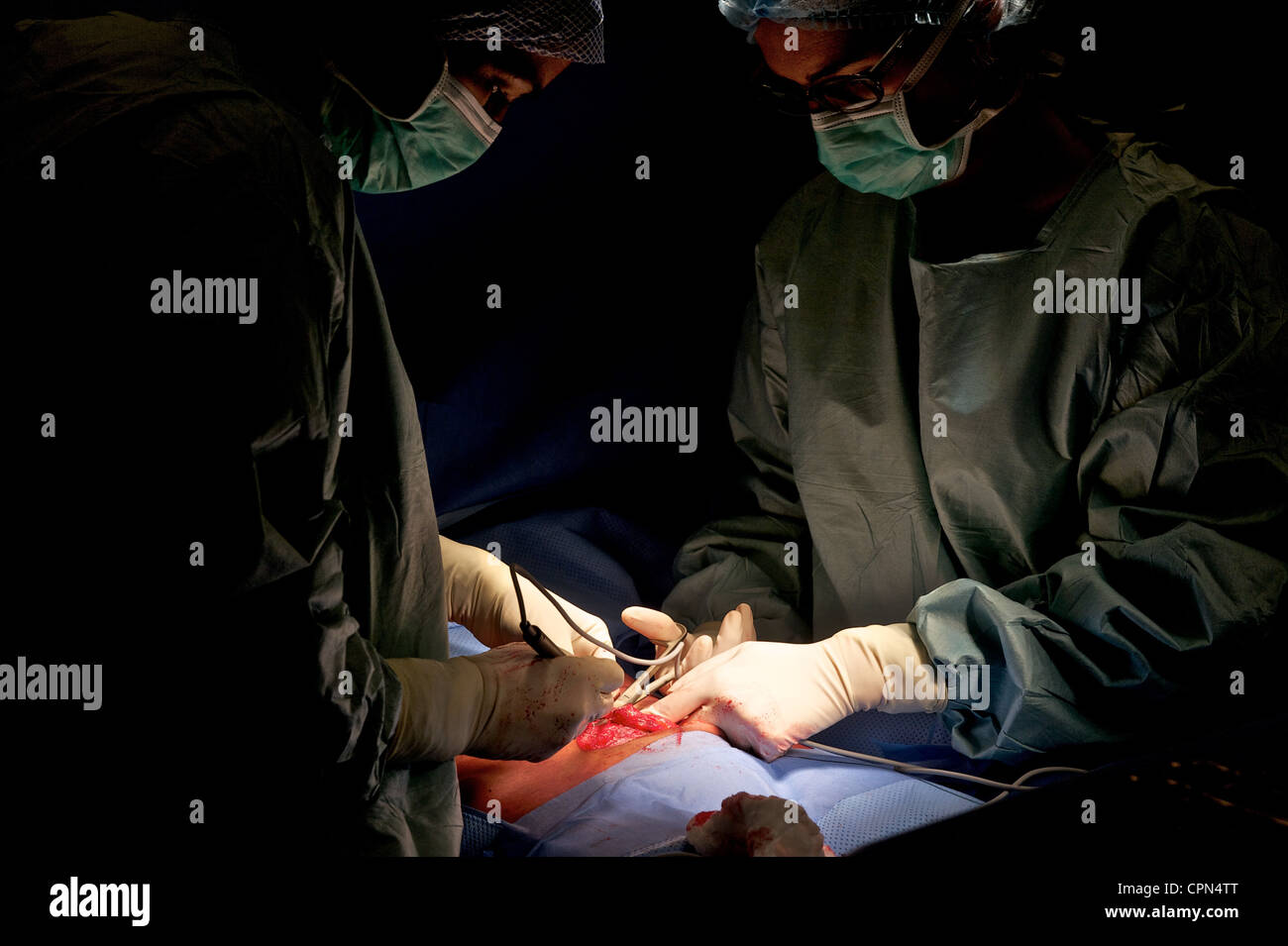 Myomectomy hi-res stock photography and images - Alamy