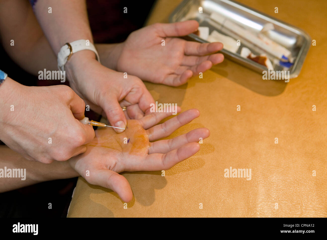 Infiltration Medical Stock Photos & Infiltration Medical Stock Images ...